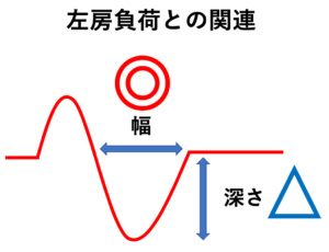 P terminal forceとは？ | 心電図.com