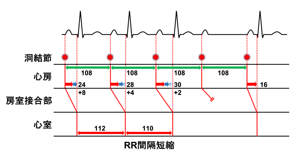 Wenckebach現象とは？ | 心電図.com