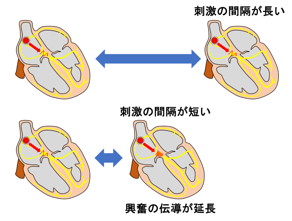 減衰伝導とは？ | 心電図.com
