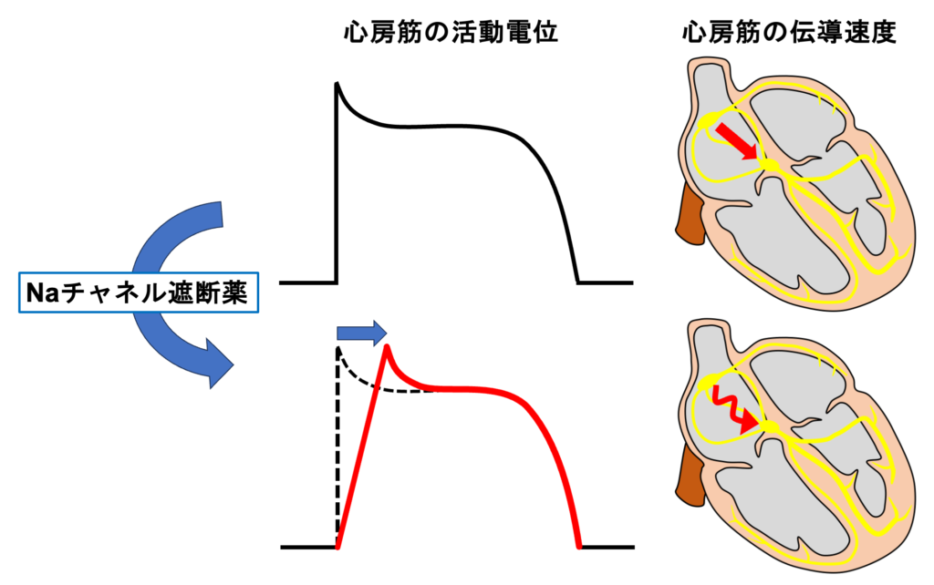 Ⅰc flutterとは？ | 心電図.com
