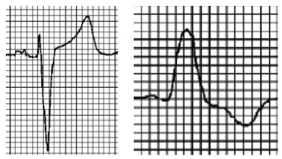 心電図完全攻略マニュアル マイスターが教える1・2級合格への最強メソッド | 心電図.com