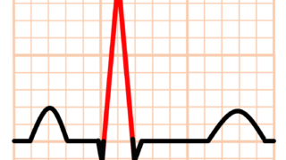 R波 | 心電図.com
