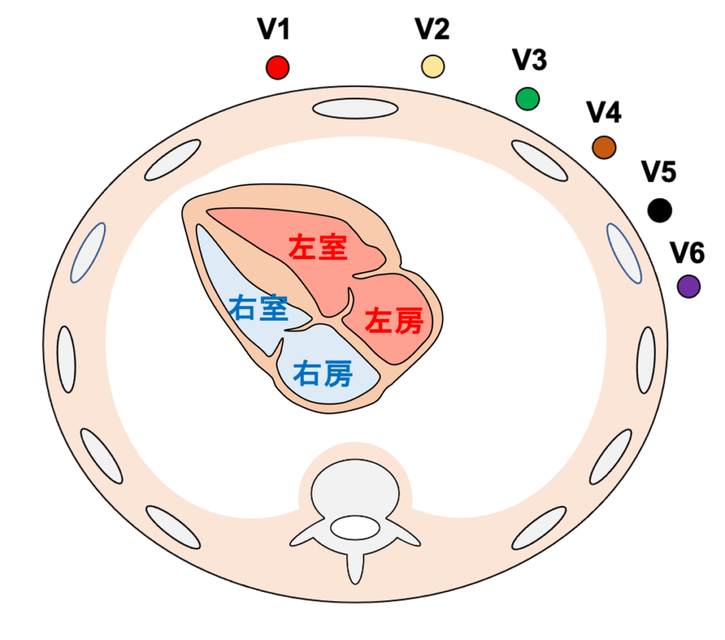 右胸心とは? | 心電図.com