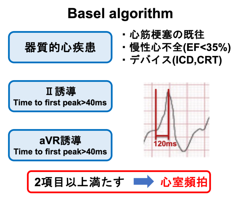 Basel algorithmとは？ | 心電図.com