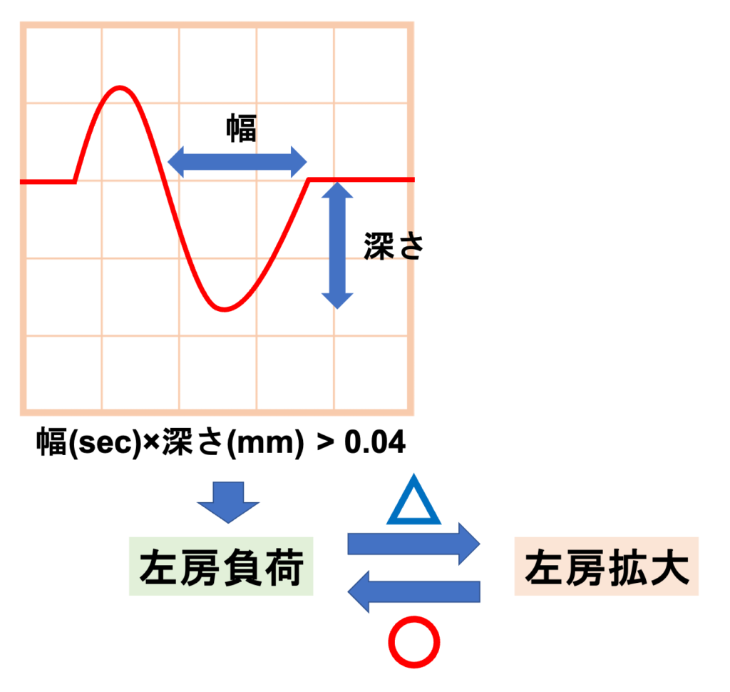 P terminal forceとは？ | 心電図.com