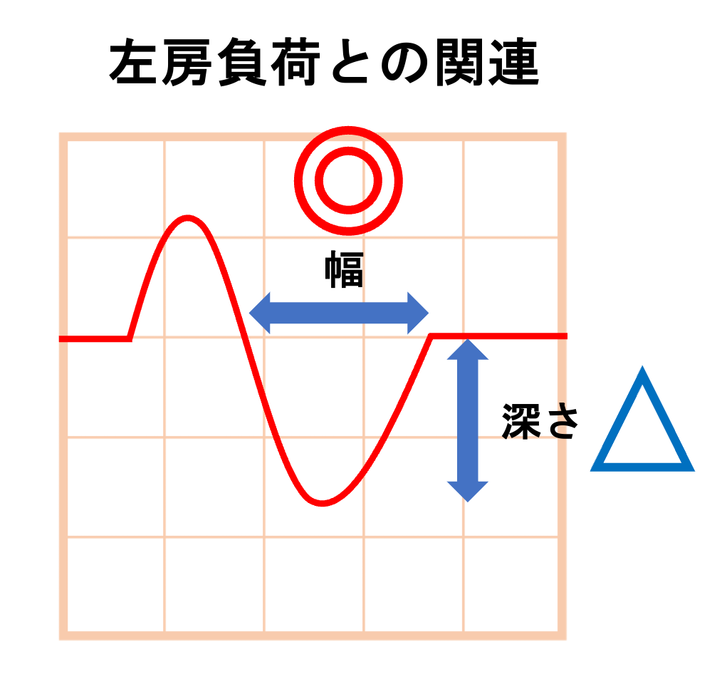 P terminal forceとは？ | 心電図.com