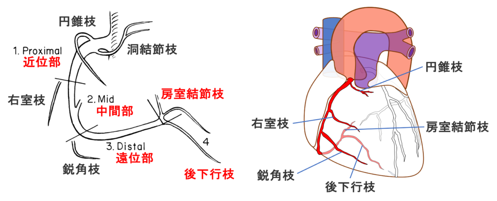 冠動脈分類とは？ | 心電図.com