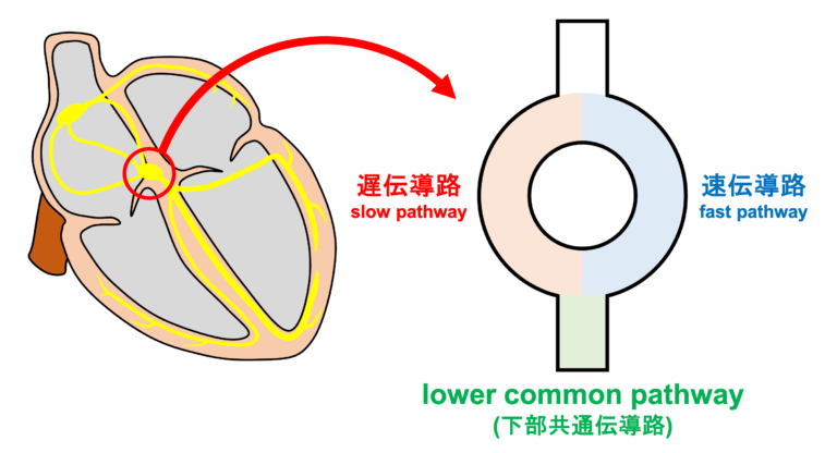lower common pathwayとは？ | 心電図.com
